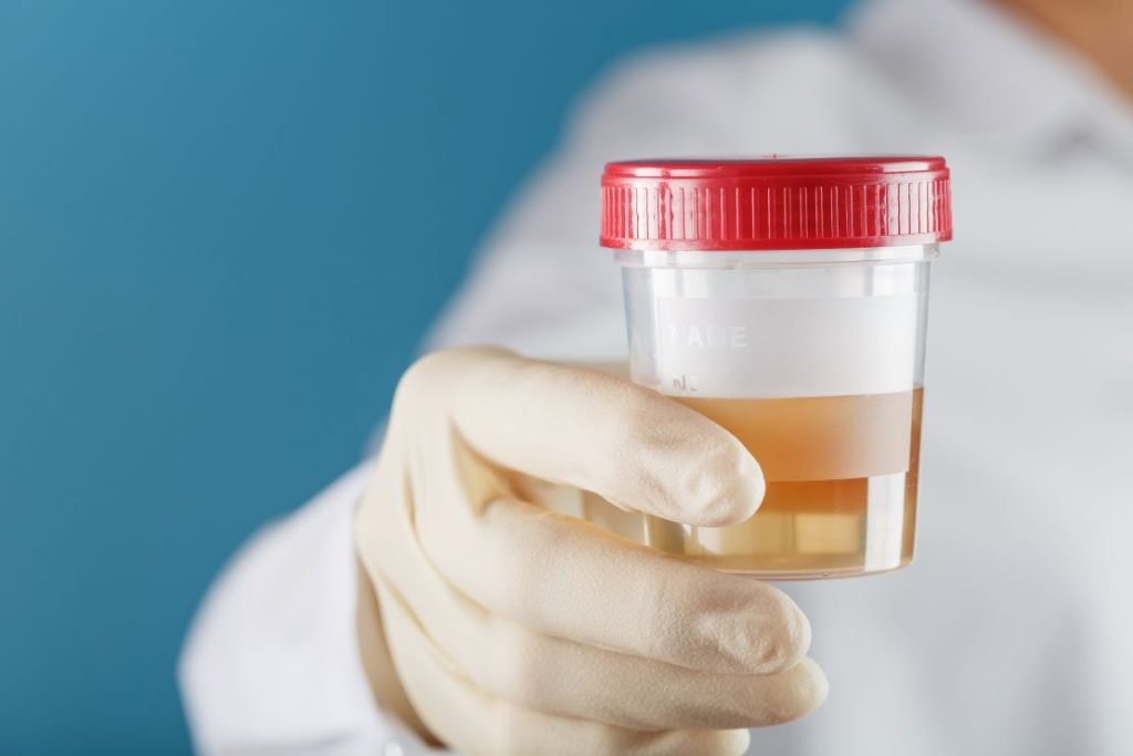 A cor da sua urina pode revelar graves problemas de saúde; VEJA